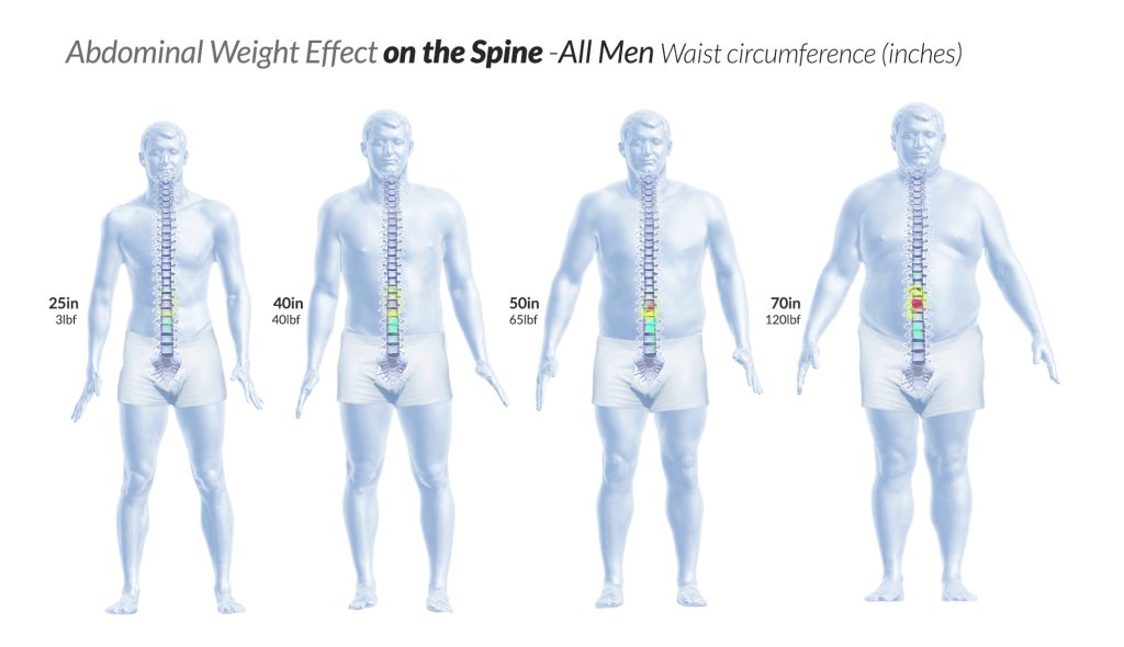A New Book, 'Watch Your Back' by Spinal Surgeon Dr. Ken Hansraj, Tells ...