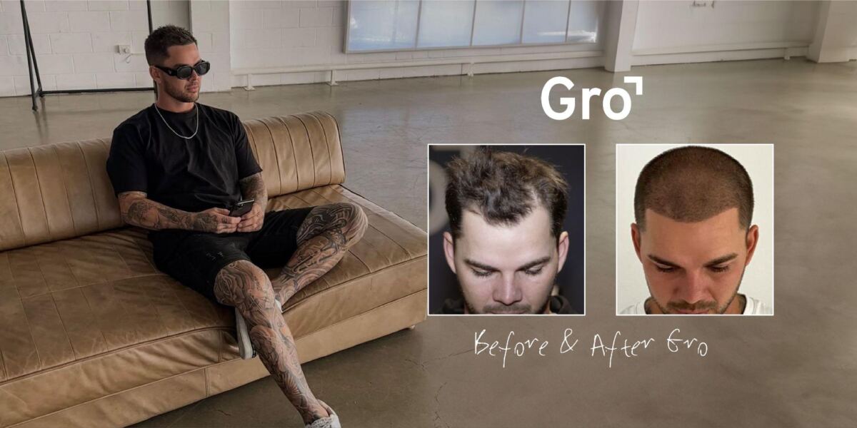 Gro Clinics Celebrates Over 26 Million Hairs Transplanted Across ...